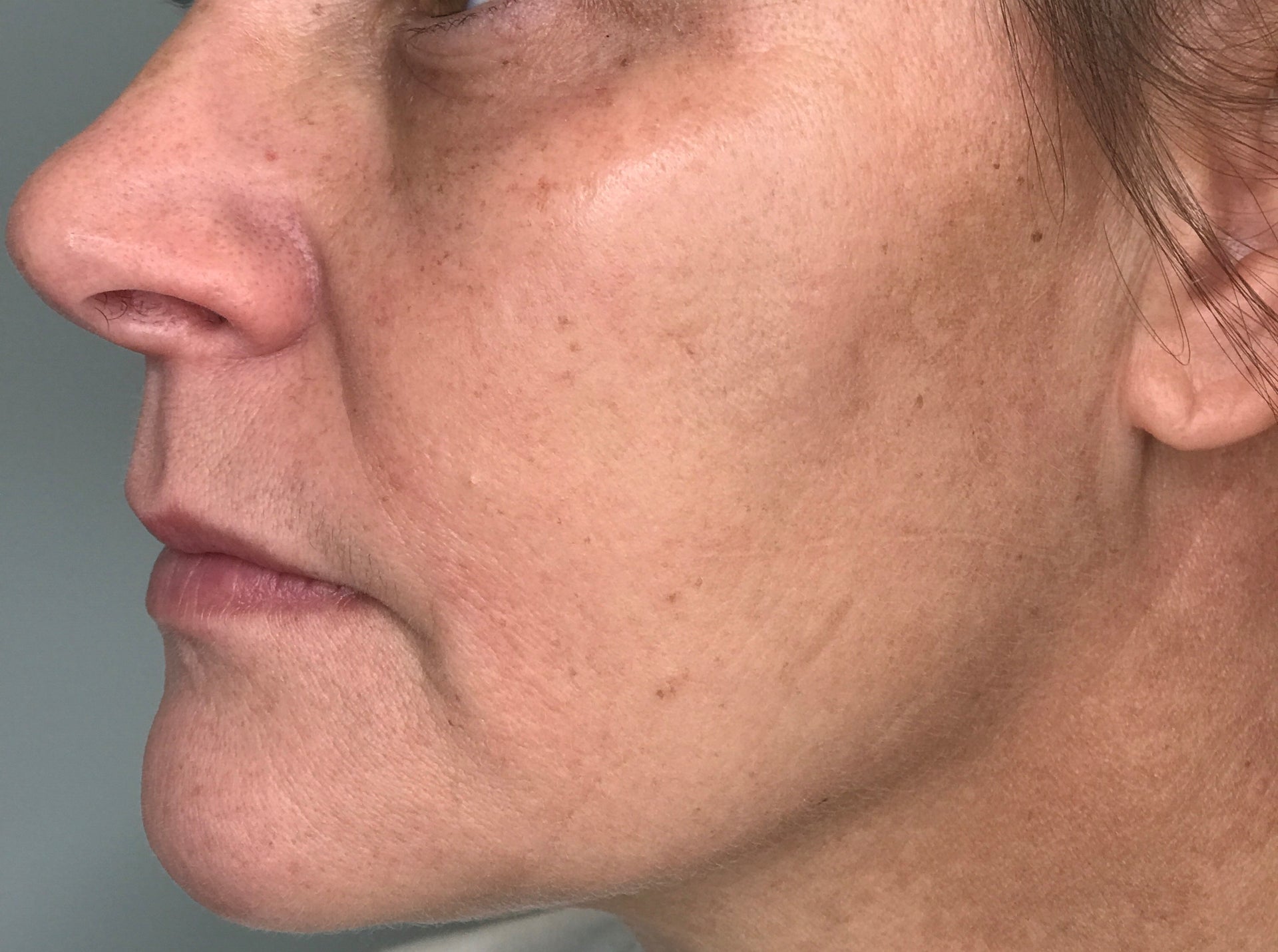 Radiance Skin Therapy Online Shop | Madison, WI – RADIANCE SKIN THERAPY ...